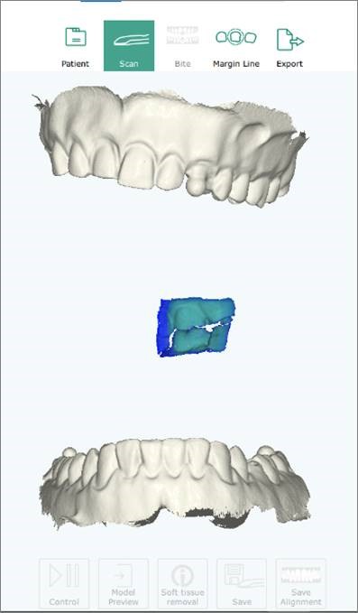 Aadva IOS 100 P | GC Europe N.V.